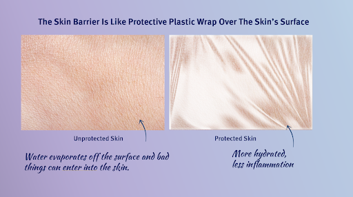 The Skin Barrier