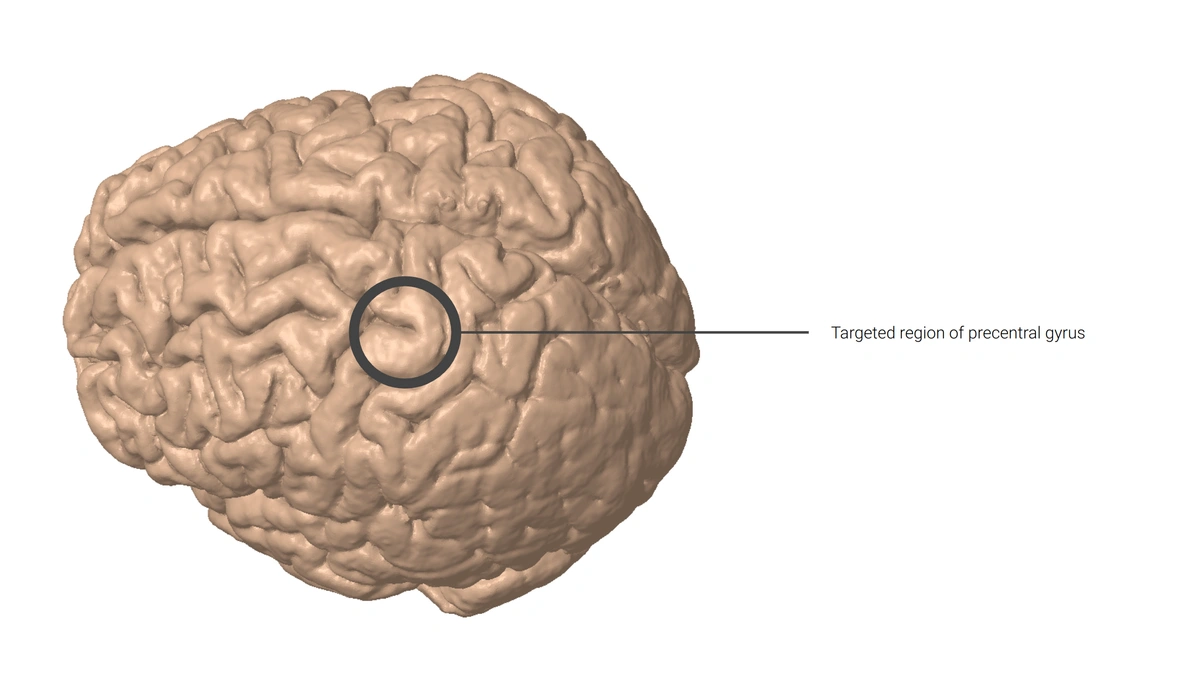 PRIME Study Progress Update | Updates | Neuralink