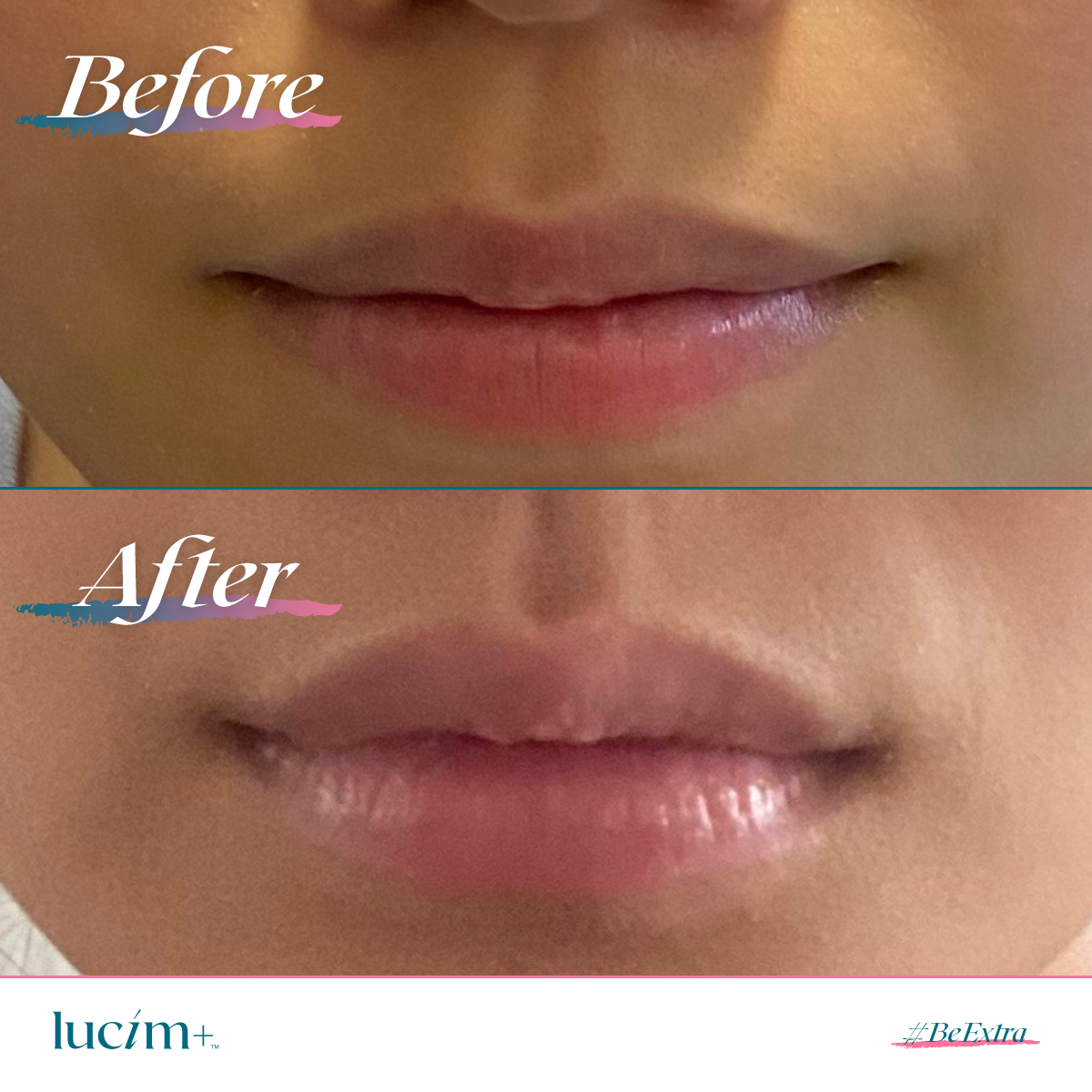 Partner.Co™ | Lucim+™ Lip Plumping Gloss