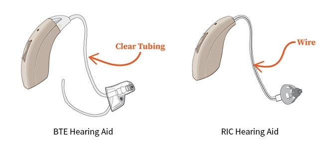 The Truth About Behind-the-Ear (BTE) Hearing Aids
