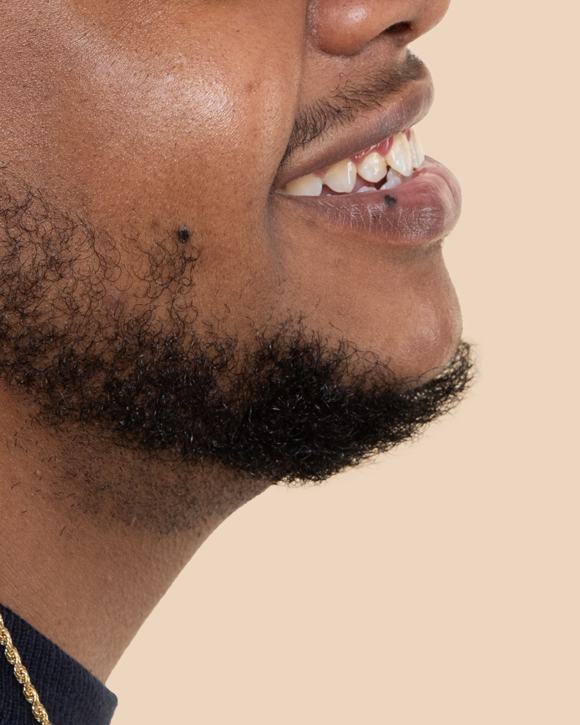 FOLX Health - Physical Changes on Testosterone Hormone Replacement ...