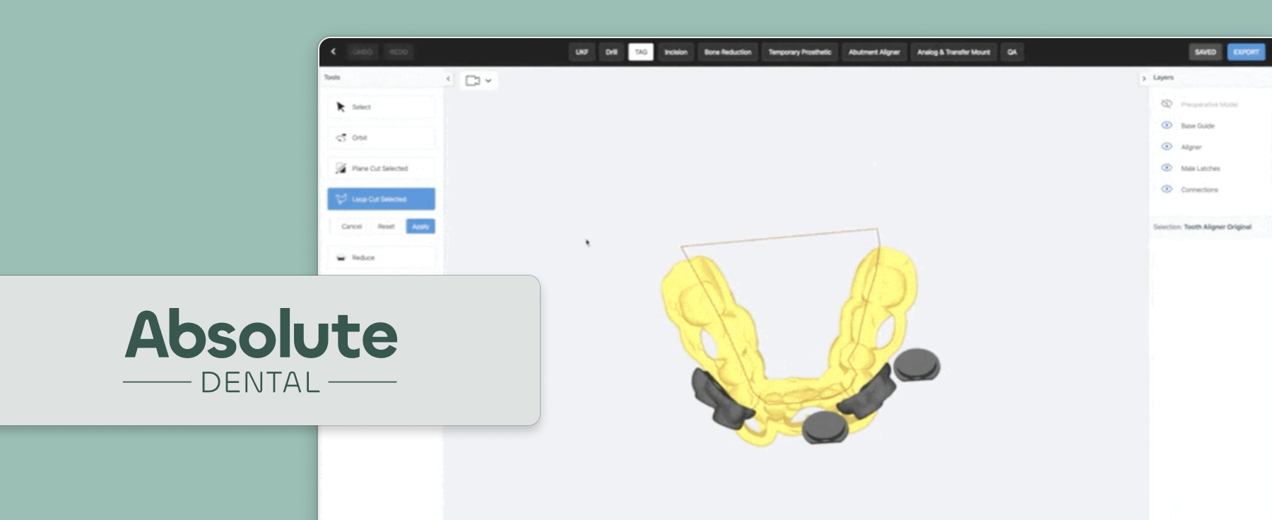 Absolute Case Study | RoleModel Software | LightningCAD