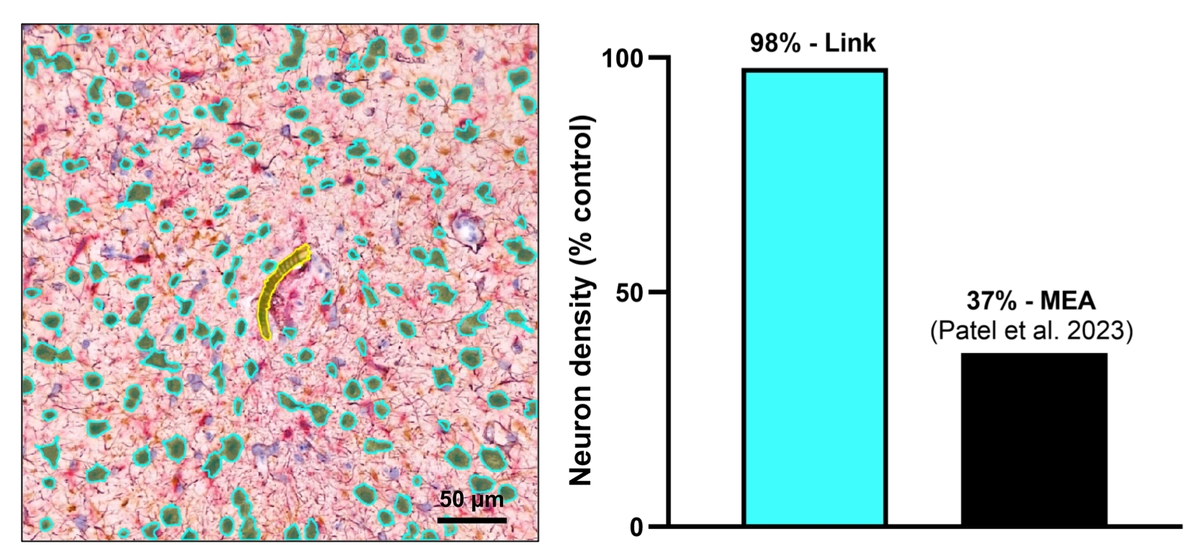 Building Safe Implantable Devices | Updates | Neuralink