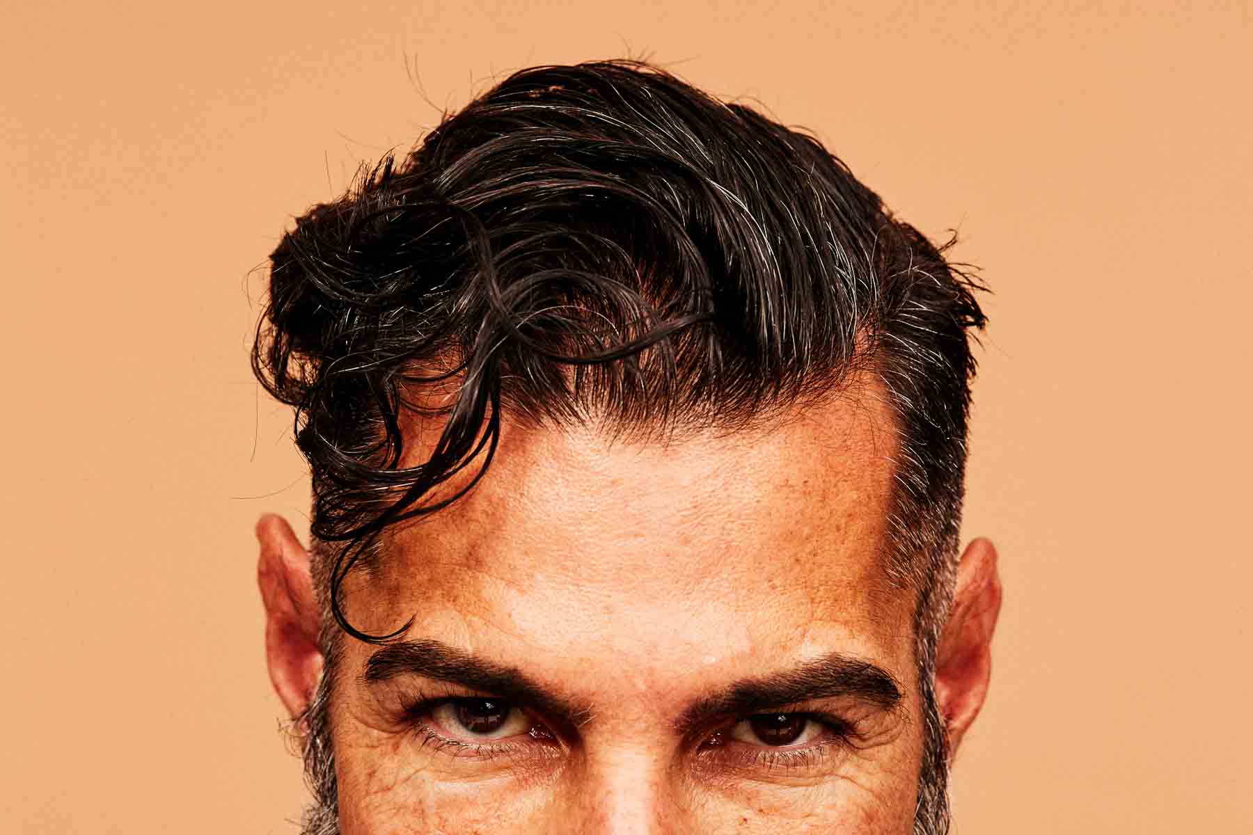 Scalp Reduction Surgery: How it Works and Alternatives | hims