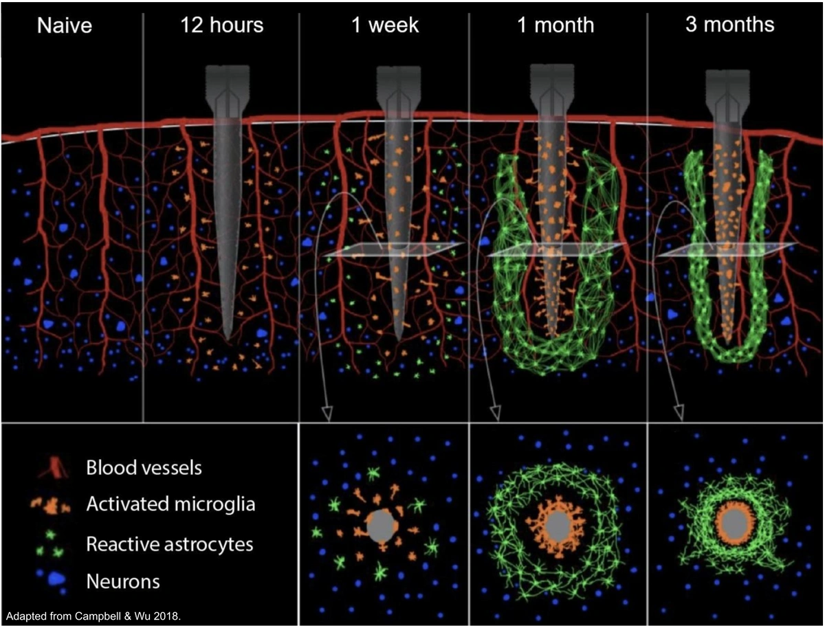 Building Safe Implantable Devices | Updates | Neuralink