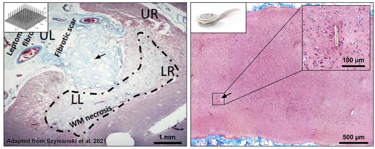 Building Safe Implantable Devices | Updates | Neuralink